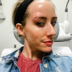 The Truth About Microblading