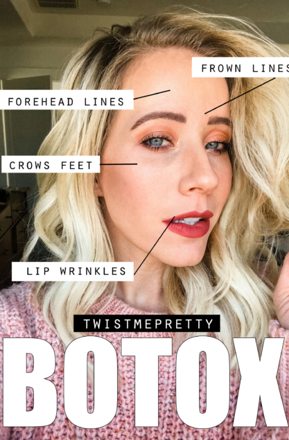 The Truth About Botox - how to not look frozen - Twist Me Pretty